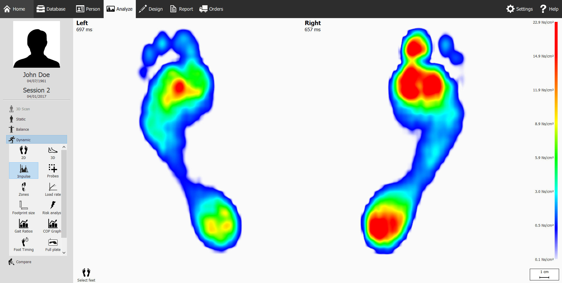 Gait Analysis - Corsham Physiotherapy